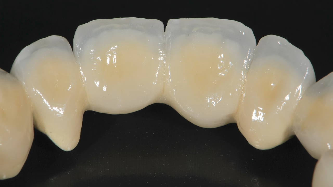 Koliko čovek ima zuba? 14 činjenica koje možda niste znali